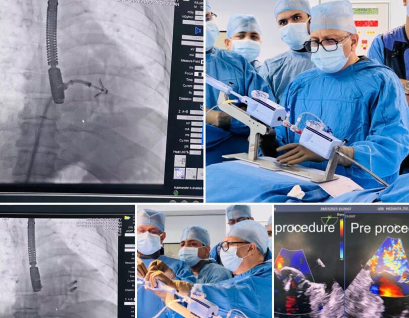 Infinite Load Button – koxmed