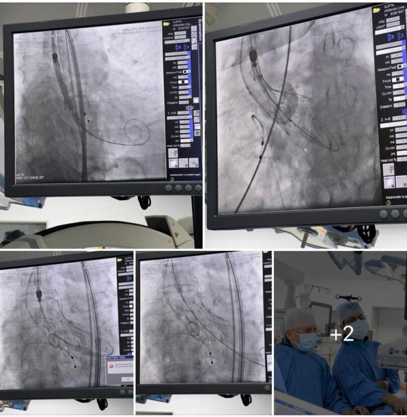 Infinite Load Button – koxmed